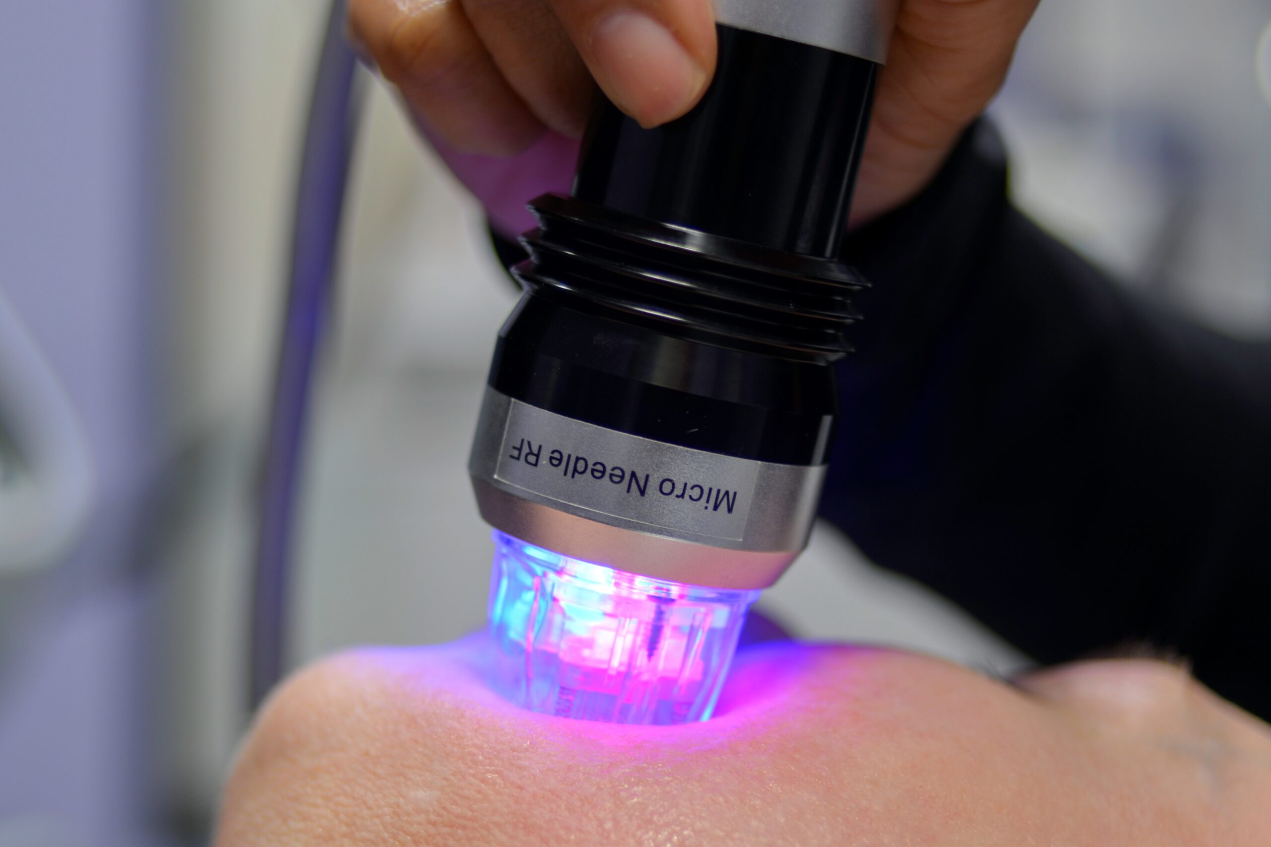 RF Needling | Dermal Medik Clinic Gold Coast